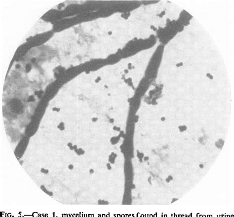 Figure 2 From Non Specific Urethritis Semantic Scholar