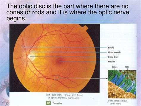 Optic Disc Definition Anatomy At Timothy Charles Blog