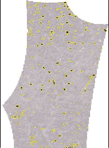 Using Trainable Weka Segmentation To Segment Cfos Ir Cells In An Image Image Analysis Image