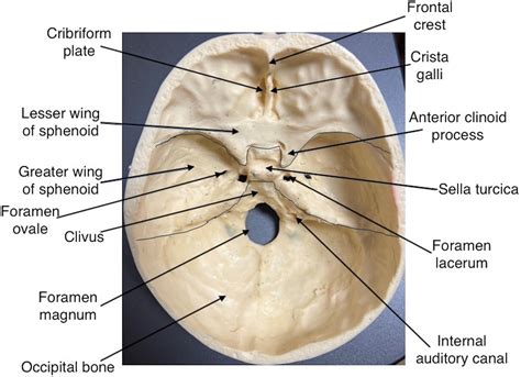 Anatomy And Imaging Of The Orbit And Skull Base Oral And