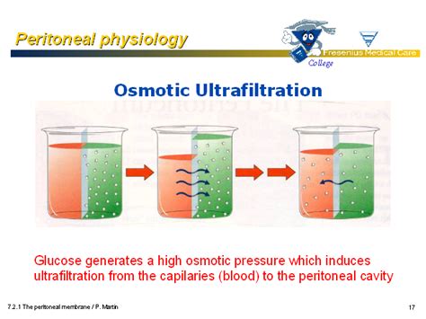 Peritoneal dialysis training Presentación PowerPoint Monografias com