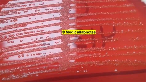 Citrobacter Freundii Introduction Morphology Pathogenicity Lab