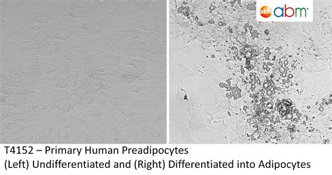 Primary Human Preadipocytes Applied Biological Materials Inc