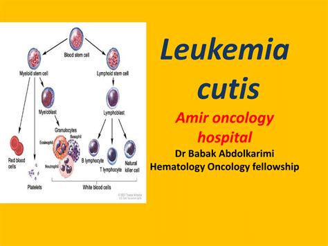 Pdf Leukemia Cutis Case Presentation