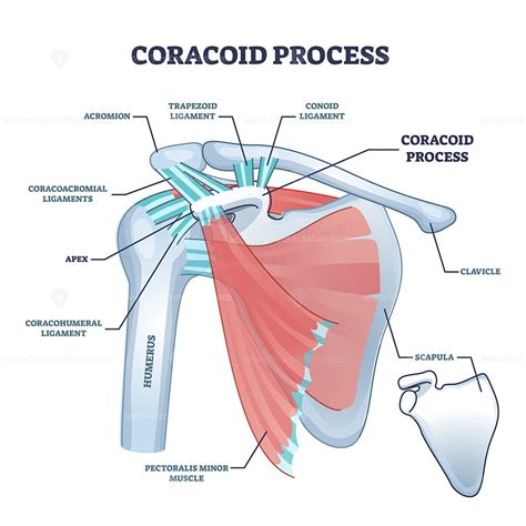 Coracoid Process Elbow Coronoid Fractures Of The Elbow Rpkk