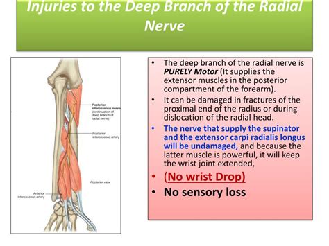 Ppt Radial And Ulnar Nerves Powerpoint Presentation Free Download Id