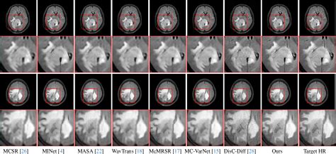 Figure 1 From Rethinking Diffusion Model For Multi Contrast Mri Super Resolution Semantic Scholar