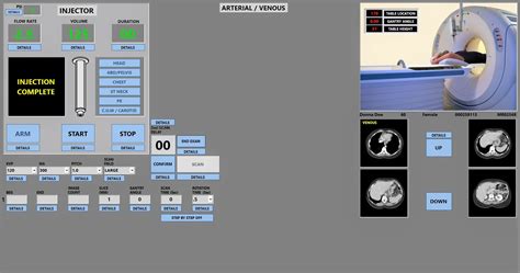 Learn Ct Protocol Multi Phase Liver