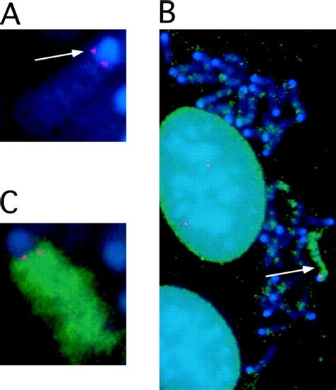 Late Replicating Xi Chromosomes In Clones With Reactivated Gfp And