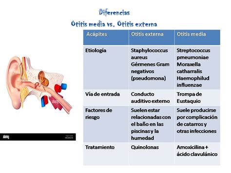 Otitis Media Vs Otitis Externa Medicina Para Todos