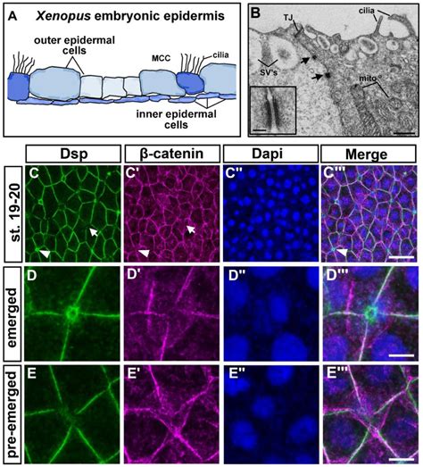 Desmosomes Histology