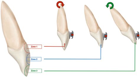 The Effect Of Changing The Vertical Bracket Position On Torque Download Scientific Diagram