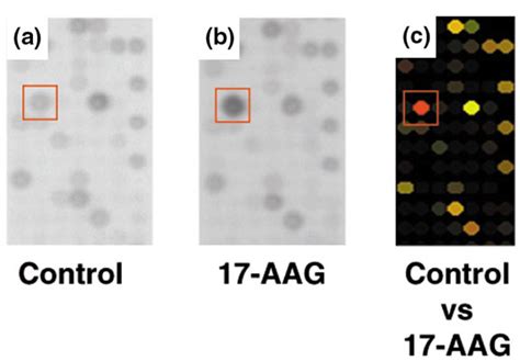 applications of microarray technology in breast cancer research pmc