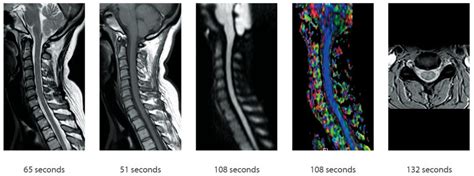 Fast Spine Protocol Canon Medical Systems Italy