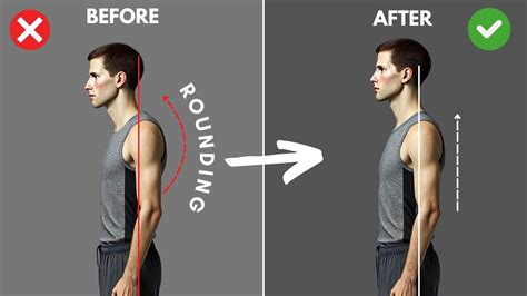 Fix Rounded Shoulders As Per Posturepro Posturepro