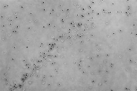 Clostridium Difficile Spores Clostridium Difficile Spores