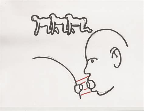 The Human Centipede First Sequence Diagrams