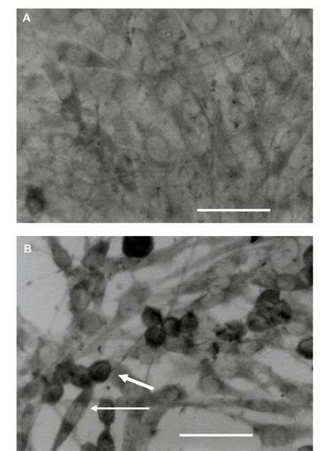 Figure From Microglia In Close Vicinity Of Glioma Cells Correlation Between Phenotype And