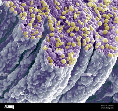 Iris Pigment Epithelium Coloured Scanning Electron Micrograph Sem Of