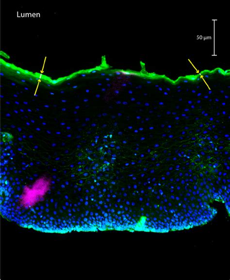 Microscopy At ϫ 20 Under Epifluorescent Microscope Showing