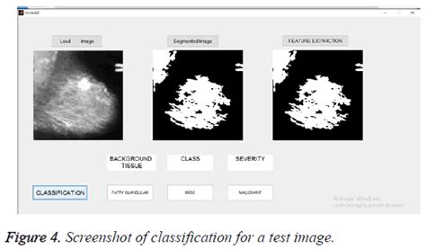 An Improved Cad System For Abnormal Mammogram Image Classification