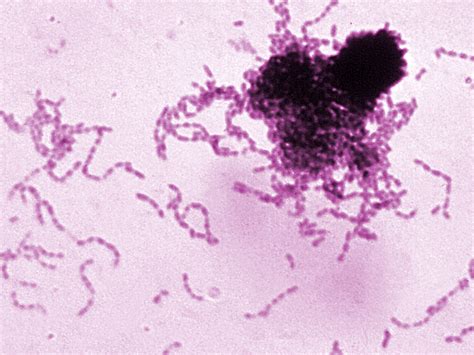 Streptococcus Mutans