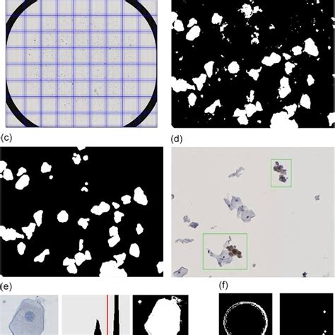 Illustration Of Object Detection A Virtual Slides Of Download Scientific