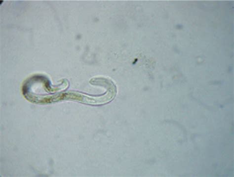 Electron Micrograph Of Enterococcus Faecalis Cect7121 And Toxocara Download Scientific Diagram