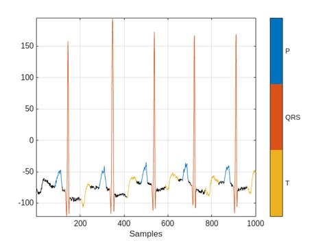 Create Labeled Signal Sets Iteratively with Reduced Human Effort MATLAB Simulink MathWorks 한국