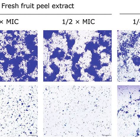 Adhesion Of Bacillus Cereus And Staphylococcus Aureus Cells In The Download Scientific Diagram