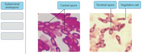 Microbiology Mastering Microbiology Homework Chapter 11 Visualize It