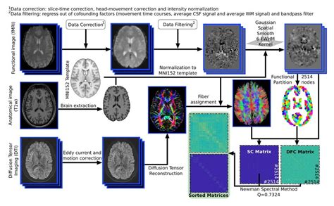 Neuroimage Preprocessing Pipeline Triple Acquisitions Were Performed Download Scientific