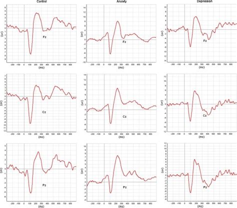 Grand Average Erps Of The Healthy Controls Patients With Anxiety Download Scientific Diagram
