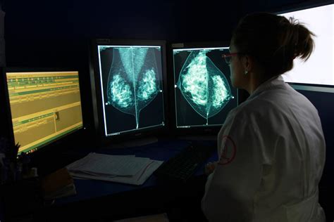Vital La Detección Temprana Del Cáncer De Mama