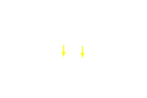 Stroma And Parenchyma 5 Digital Histology