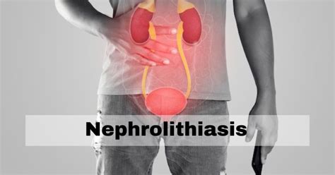 Nephrolithiasis Causes Symptoms And Treatment Options Vnh