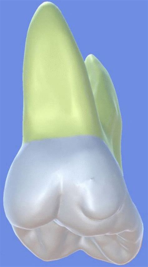 The Carabelli Cusp Is Visible On The Palatal Surface Of The