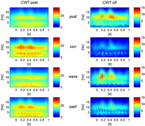 Group Level Based Cwt Absolute Values Left Cwt Of The Eeg Signals Download Scientific