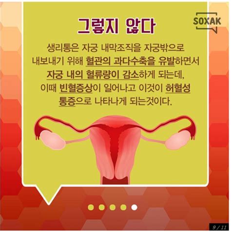 생리통에 대한 잘못된 상식 가지 포스트쉐어