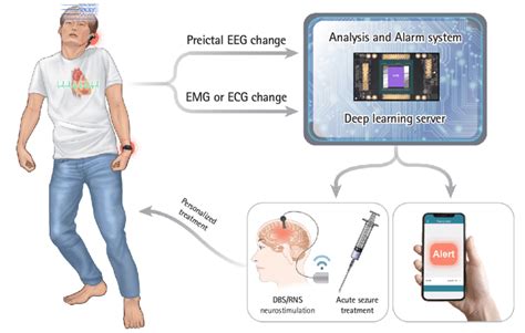Alarm And Prevention System Based On Seizure Prediction An Accident Download Scientific
