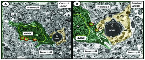 Ramified Surveilling Microglia Cells Rmgcs In Control Non Diabetic