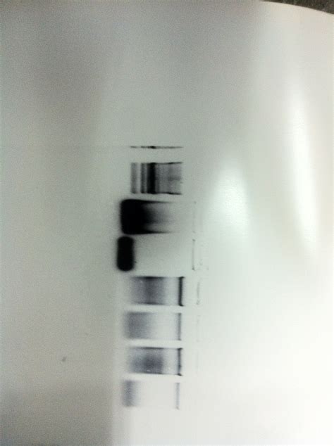 18 Questions With Answers In Epididymis Science Topic