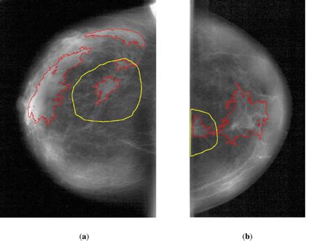 Example False Positive Wavecluster Results Overlaid On Original Images
