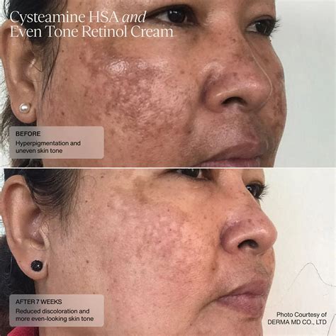 Cystamine Divina Dermatology