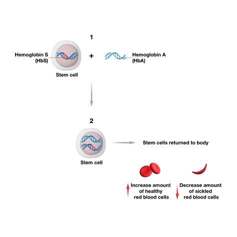 Understanding Gene Therapy Approaches