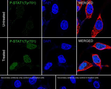 Phospho Stat1 Y701 Recombinant Rabbit Monoclonal Antibody Psh04 02