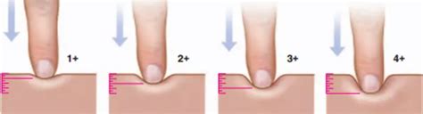 Episode 97 Cascading Prescriptions The Curious Clinicians