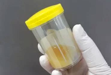 Urine Culture