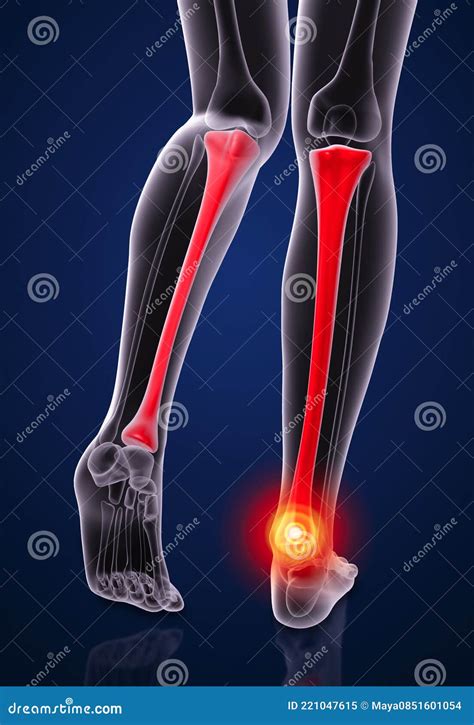 Tibia Bone Royalty Free Cartoon CartoonDealer Com