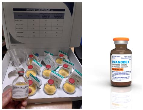 Malignant Hyperthermia Openanesthesia